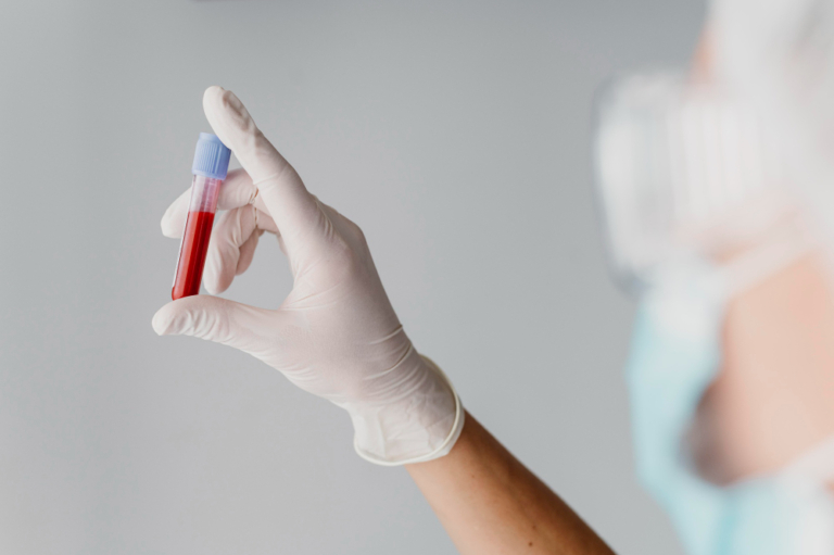 What Is a Full Blood Test to Check Everything?